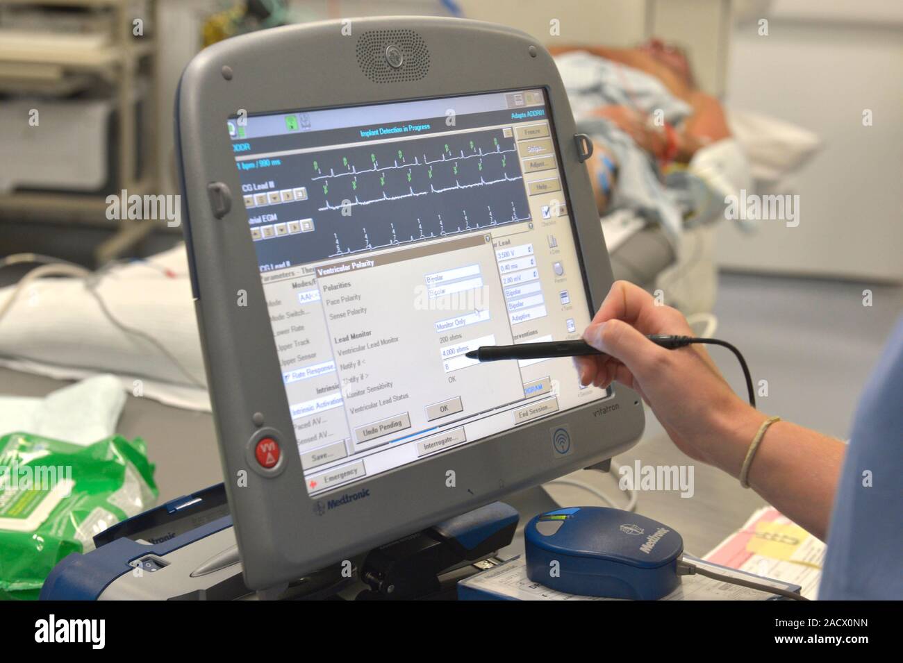Hospital monitor displaying information about a patient's heart ...