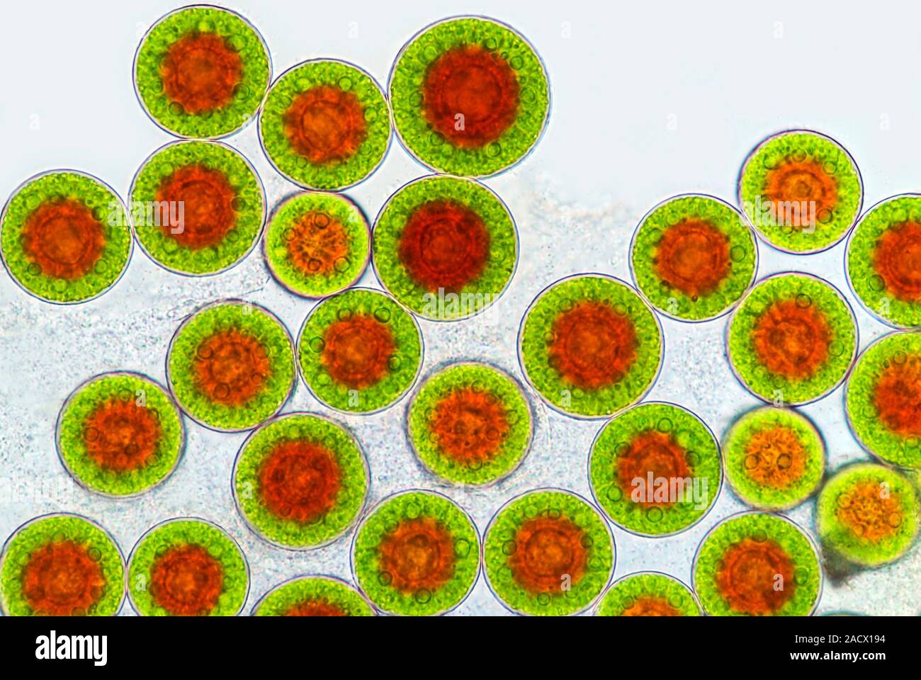 Light micrograph of green algae (Haematococcus pluvialis), during their ...