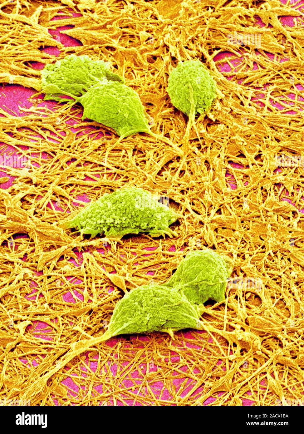Nervous system cells. Coloured scanning electron micrograph (SEM) of ...