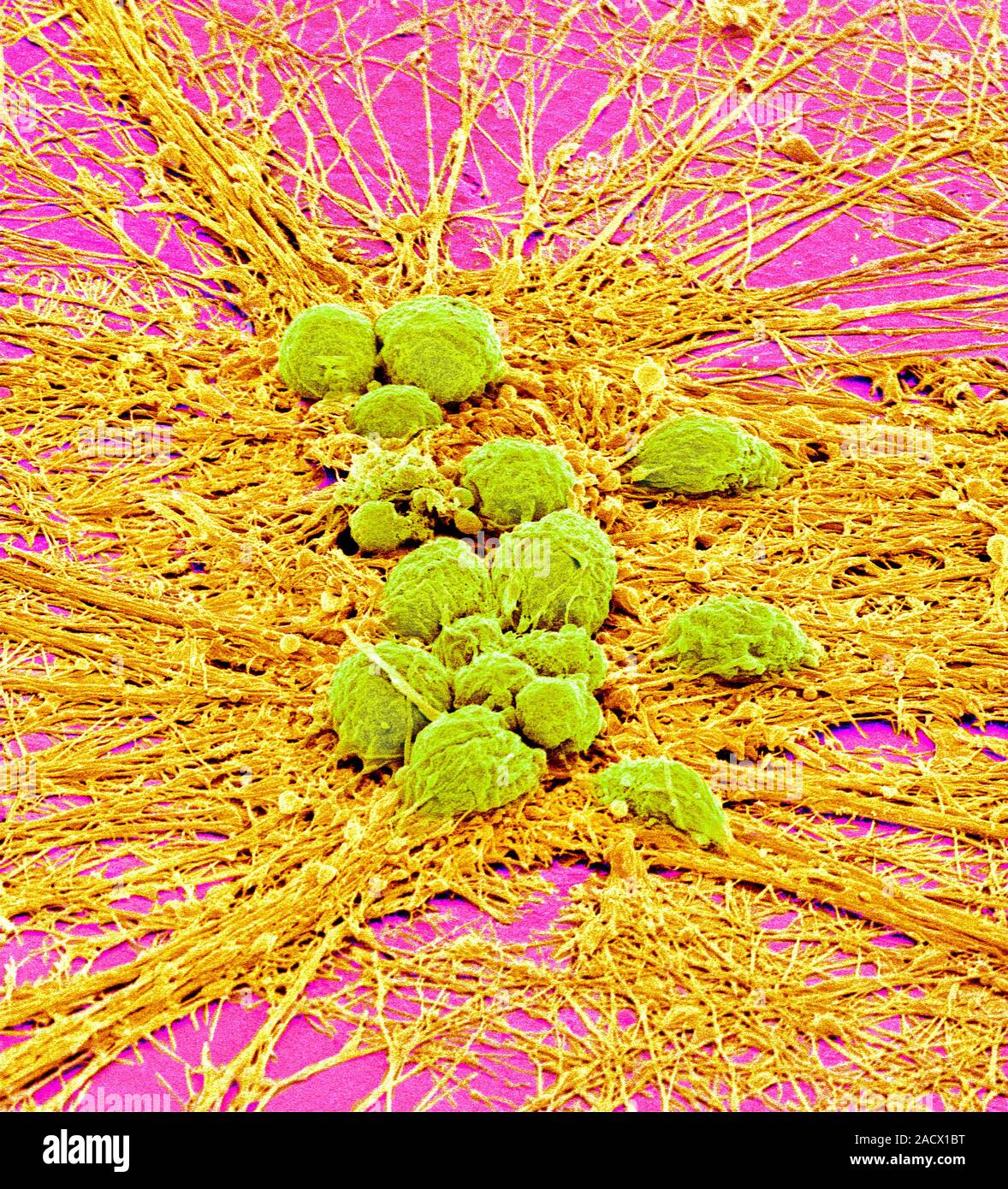 Nervous system cells. Coloured scanning electron micrograph (SEM) of ...