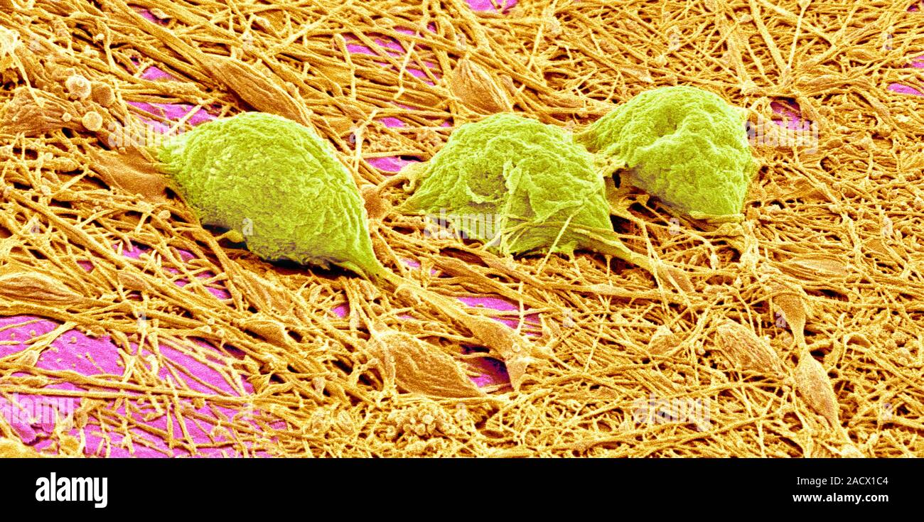 Nervous system cells. Coloured scanning electron micrograph (SEM) of ...