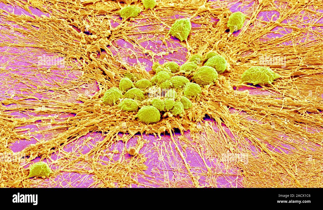 Nervous system cells. Coloured scanning electron micrograph (SEM) of ...