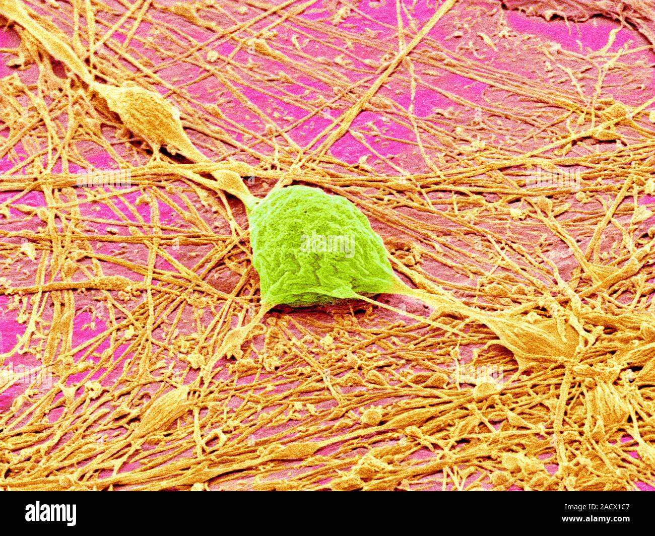 Nervous system cells. Coloured scanning electron micrograph (SEM) of ...