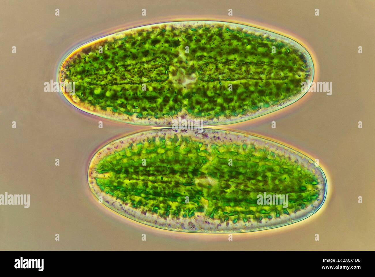 Polarised light micrograph of Netrium sp. desmids. Desmids are an order ...