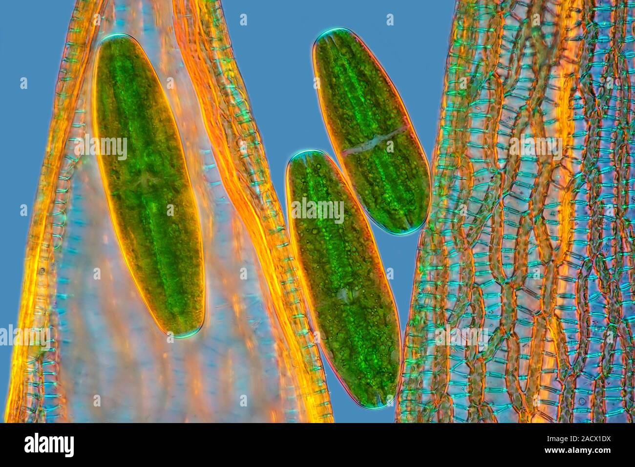 Polarised light micrograph of Netrium sp. desmids. Desmids are an order ...