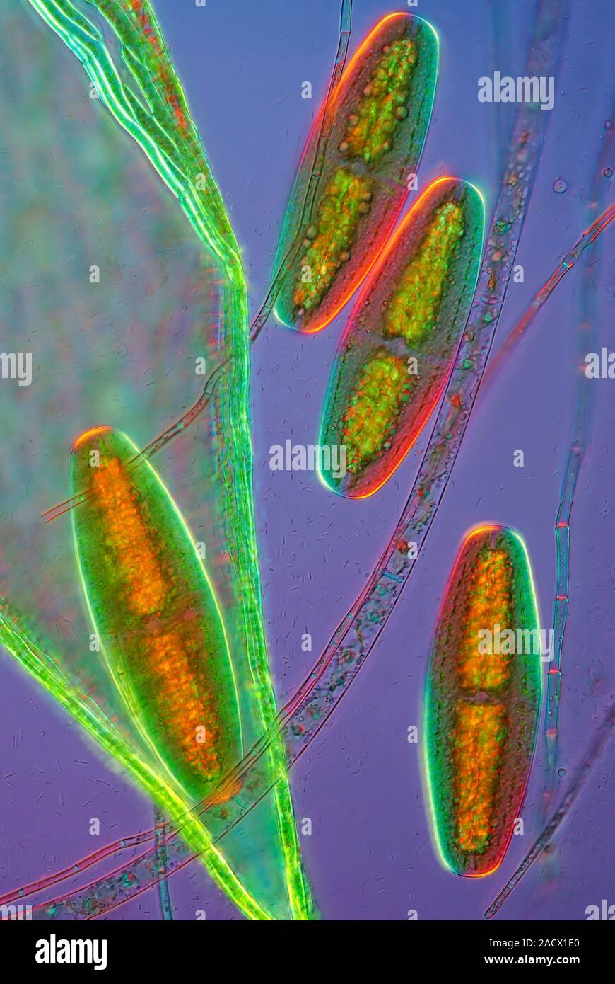 Polarised light micrograph of Netrium sp. desmids. Desmids are an order ...