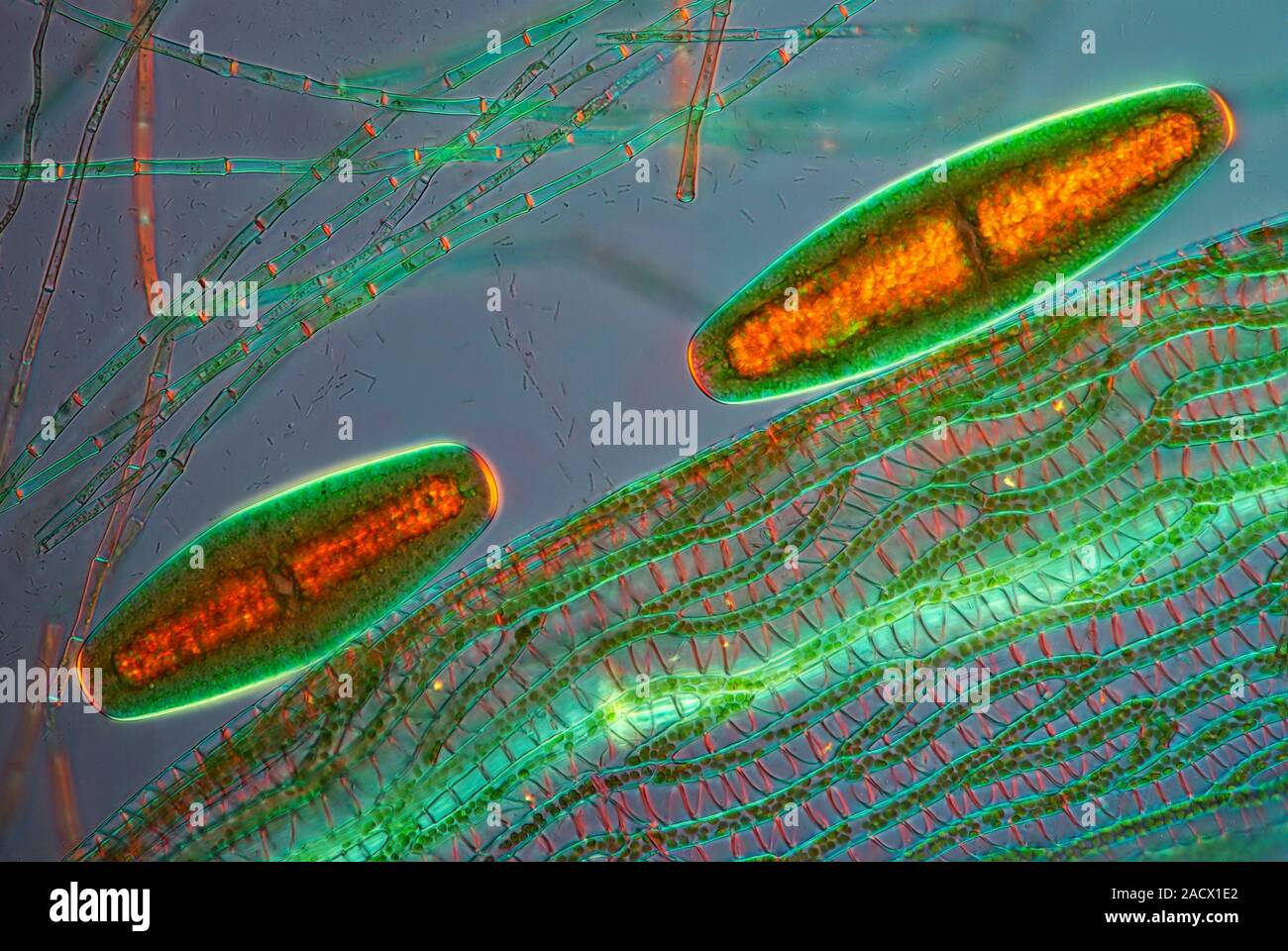 Polarised light micrograph of Netrium sp. desmids. Desmids are an order ...