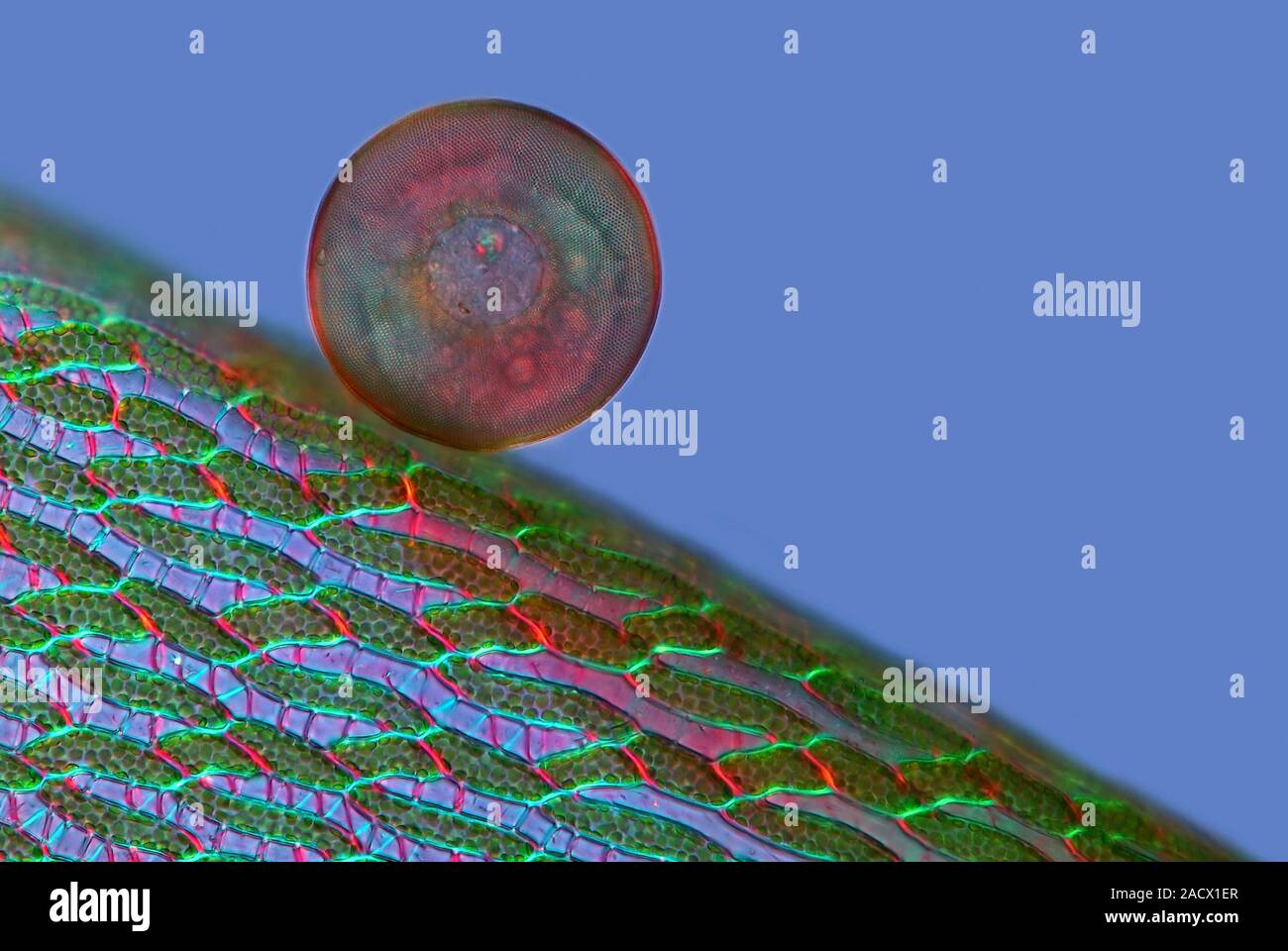 Polarised light micrograph of an Arcella sp. shelled amoeba on a moss ...