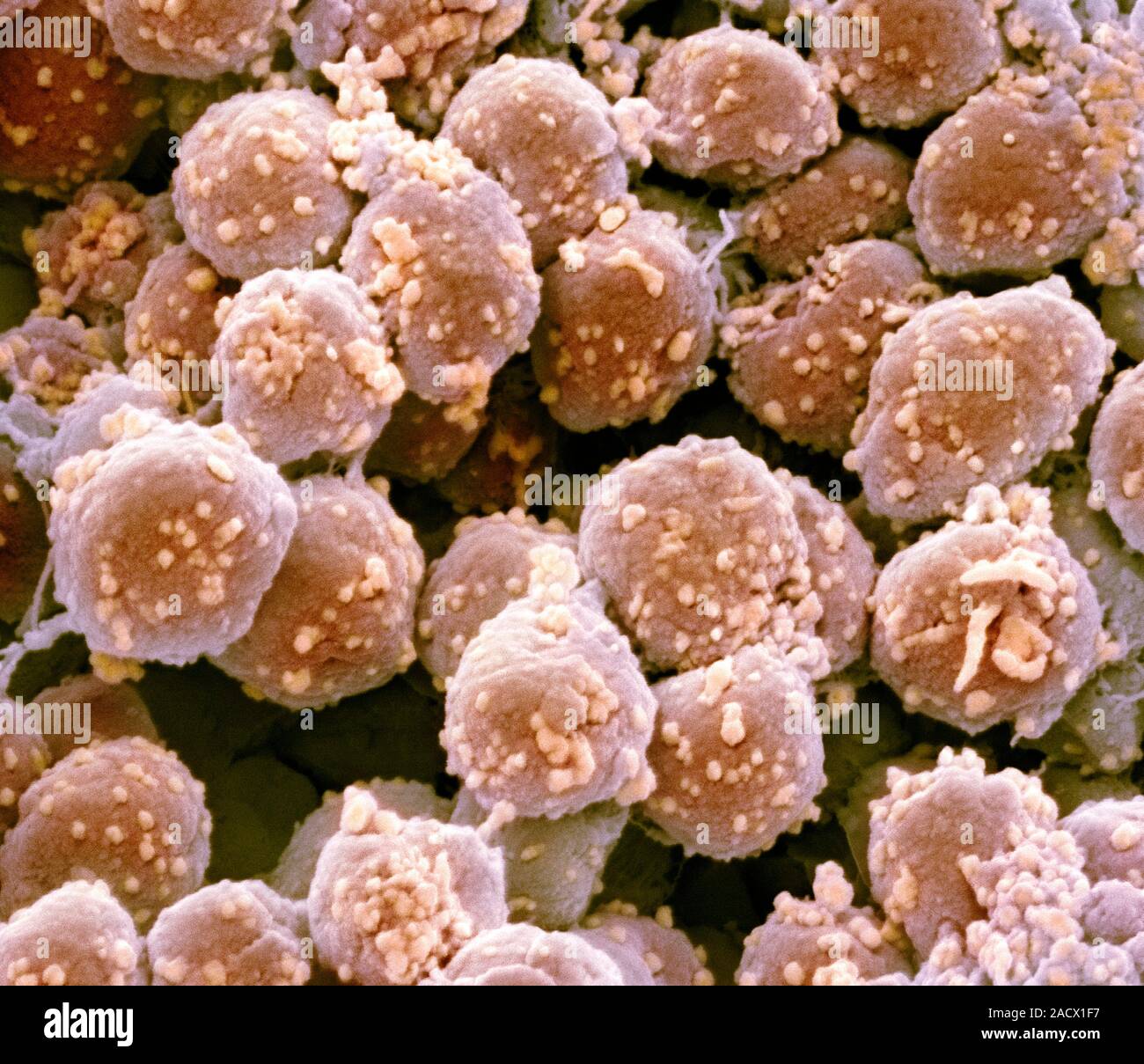 Archaea, coloured scanning electron micrograph (SEM). Archaea are a ...