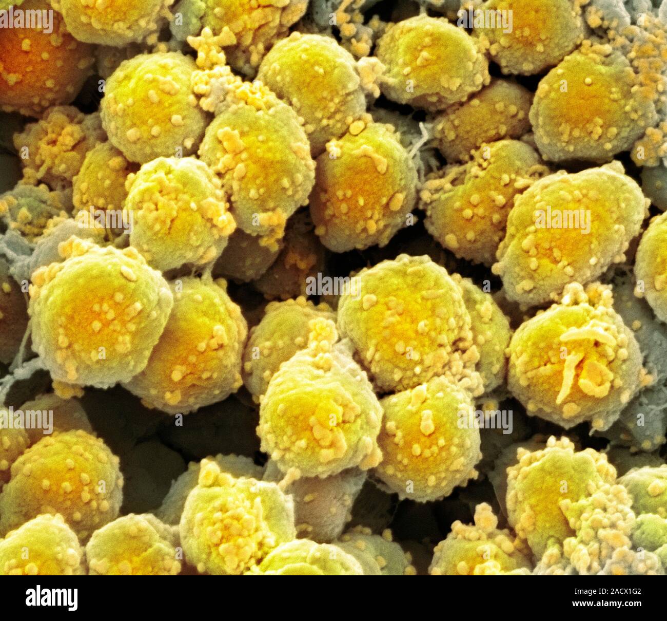 Archaea, coloured scanning electron micrograph (SEM). Archaea are a ...