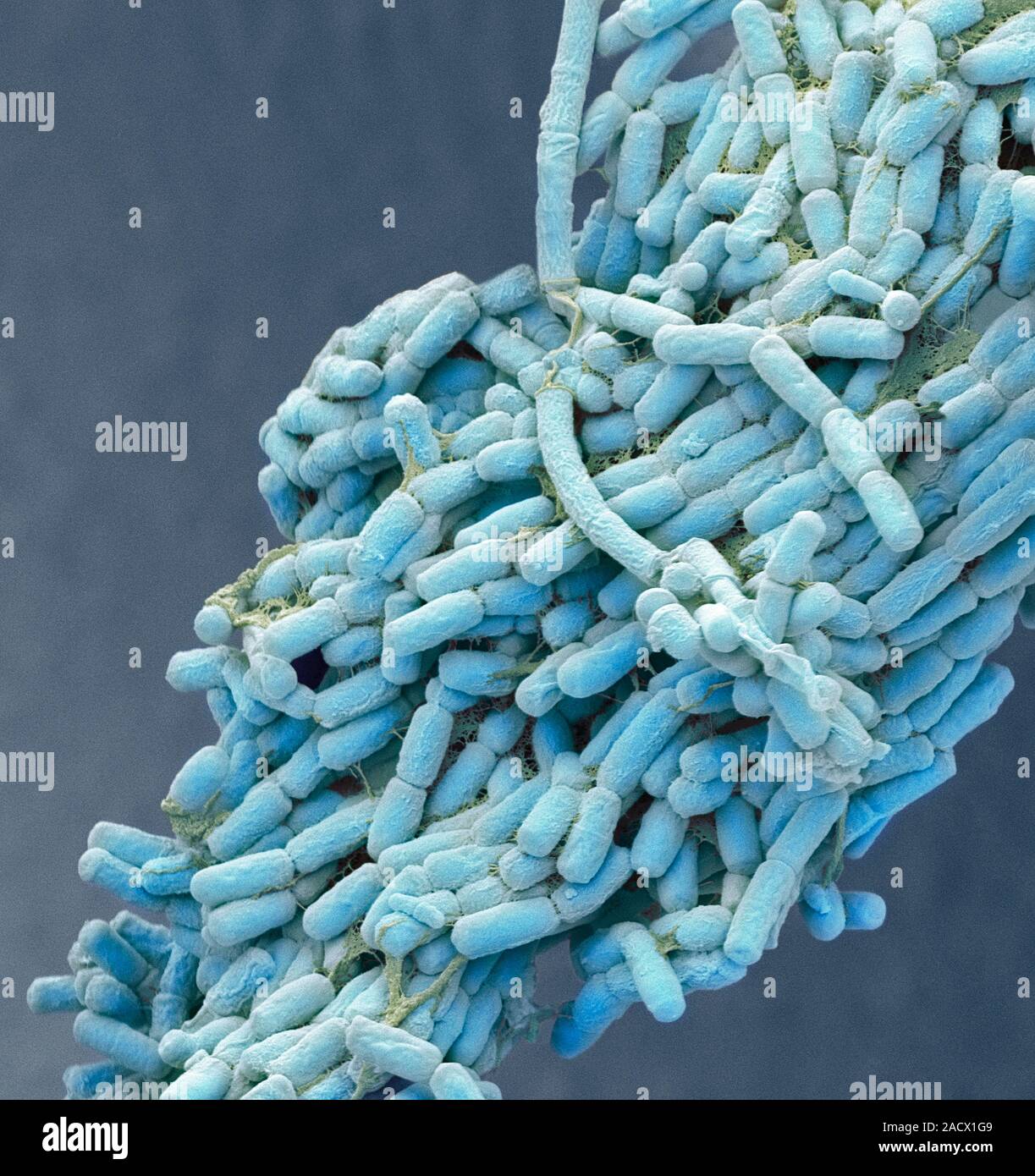 E. coli bacteria. Coloured scanning electron micrograph (SEM) of ...