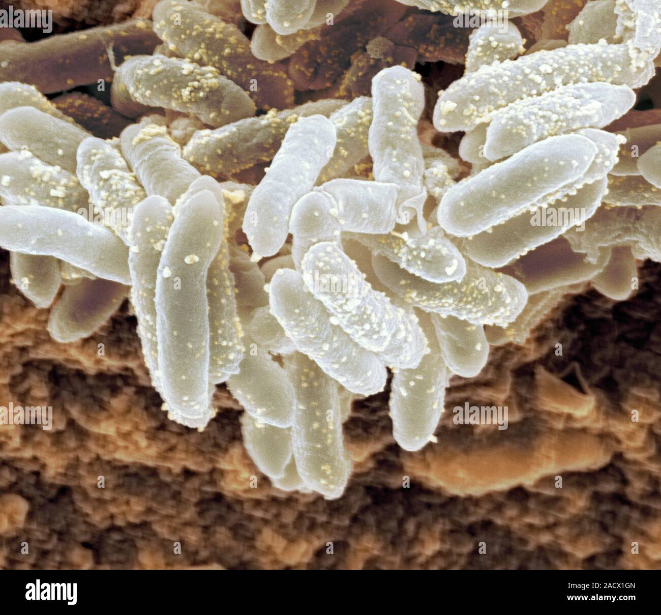 Erwinia bacteria. Coloured scanning electron micrograph (SEM) of the ...