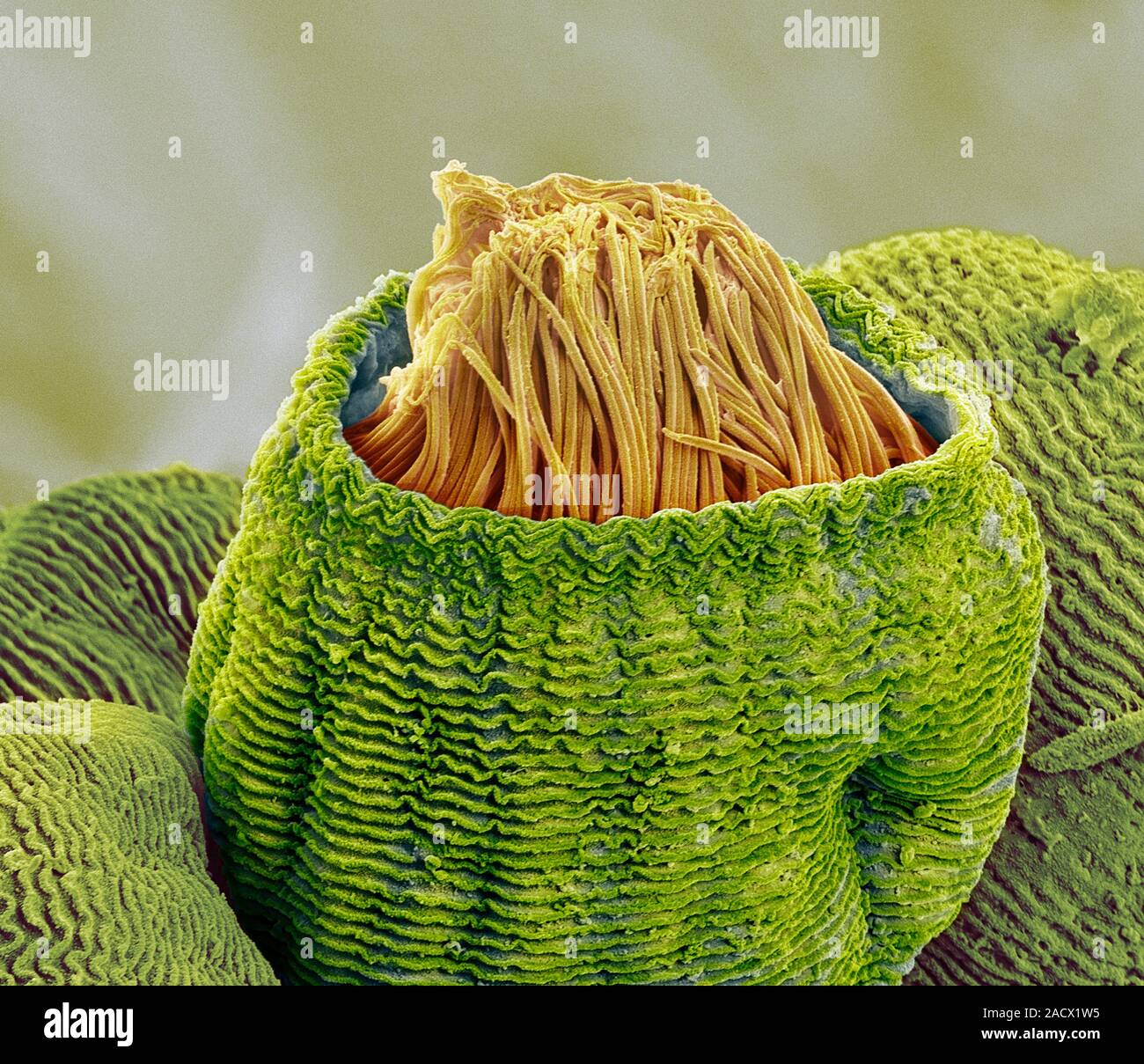 Vorticella sp. ciliate protozoan, coloured scanning electron micrograph ... Vorticella sp. ciliate protozoan, coloured scanning electron micrograph ...