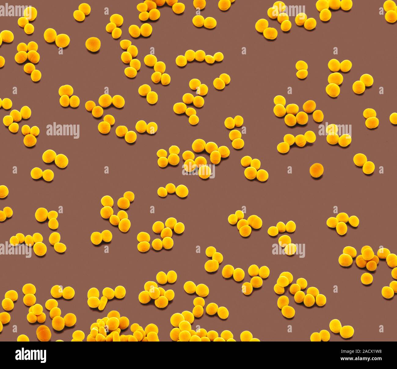 Staphylococcus epidermidis bacteria, coloured scanning electron ...