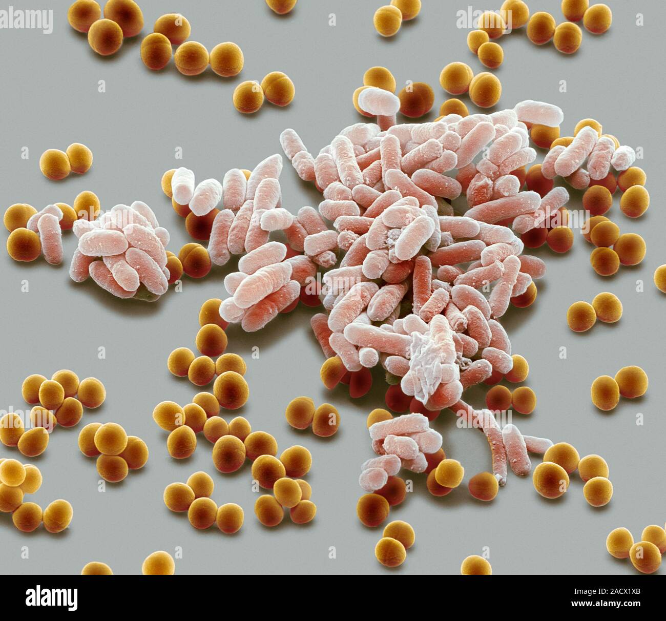 Coloured scanning electron micrograph (SEM) of Staphylococcus ...