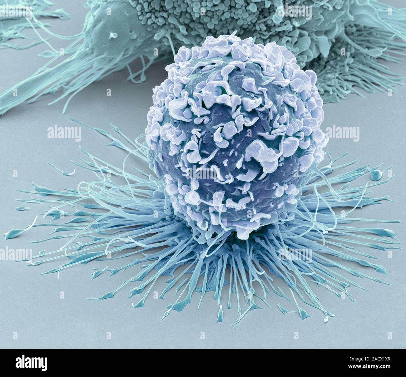 Activated macrophage. Coloured scanning electron micrograph (SEM) of an active macrophage white ...
