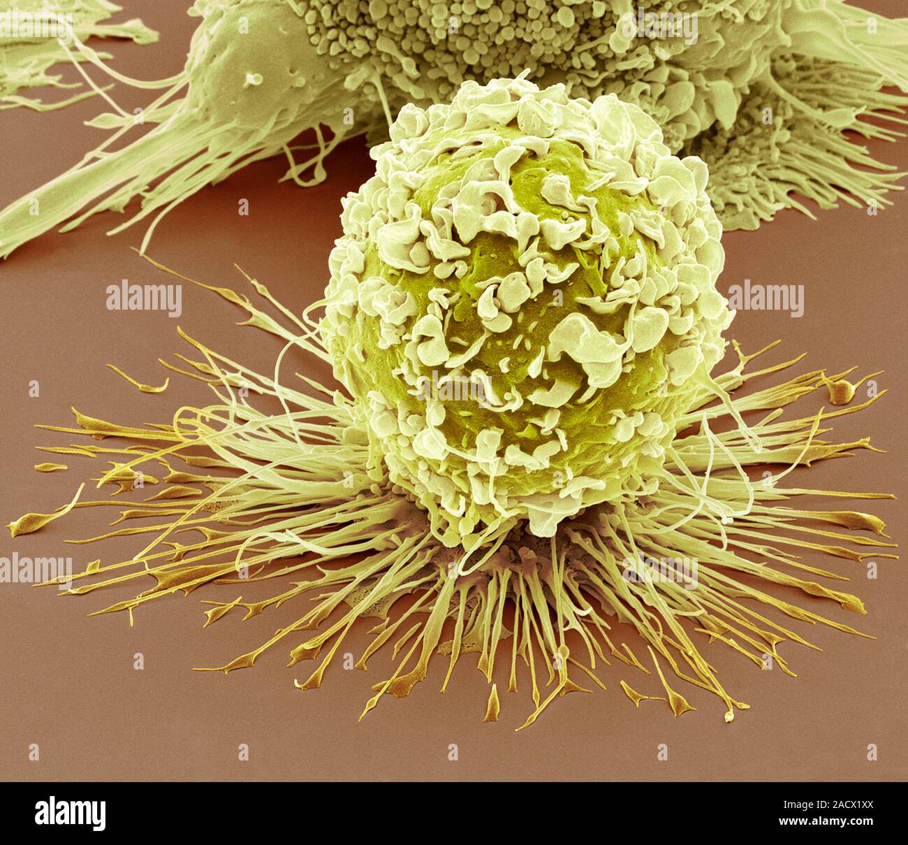 Activated macrophage. Coloured scanning electron micrograph (SEM) of an active macrophage white ...