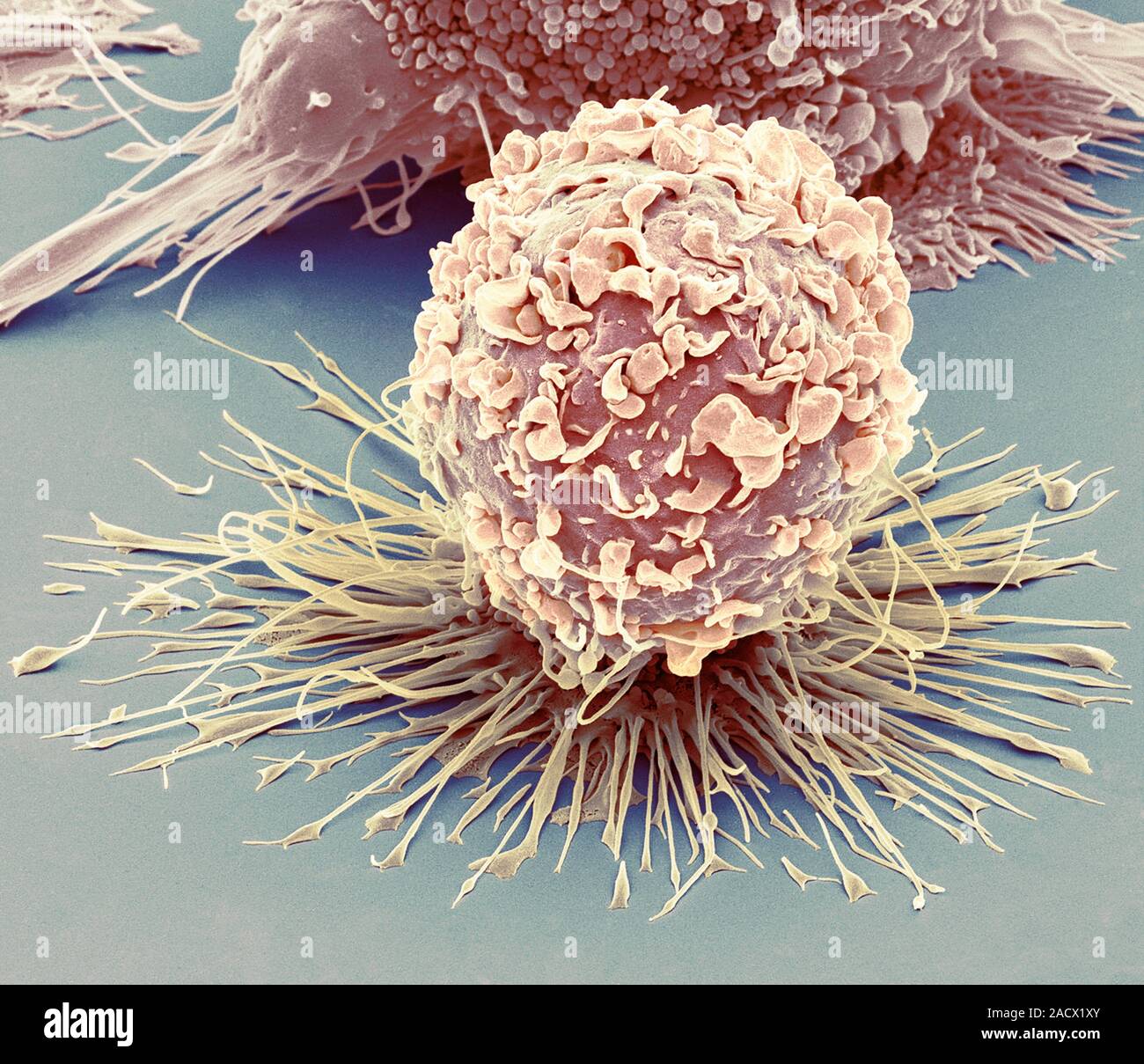 Activated macrophage. Coloured scanning electron micrograph (SEM) of an ... Activated macrophage. Coloured scanning electron micrograph (SEM) of an ...
