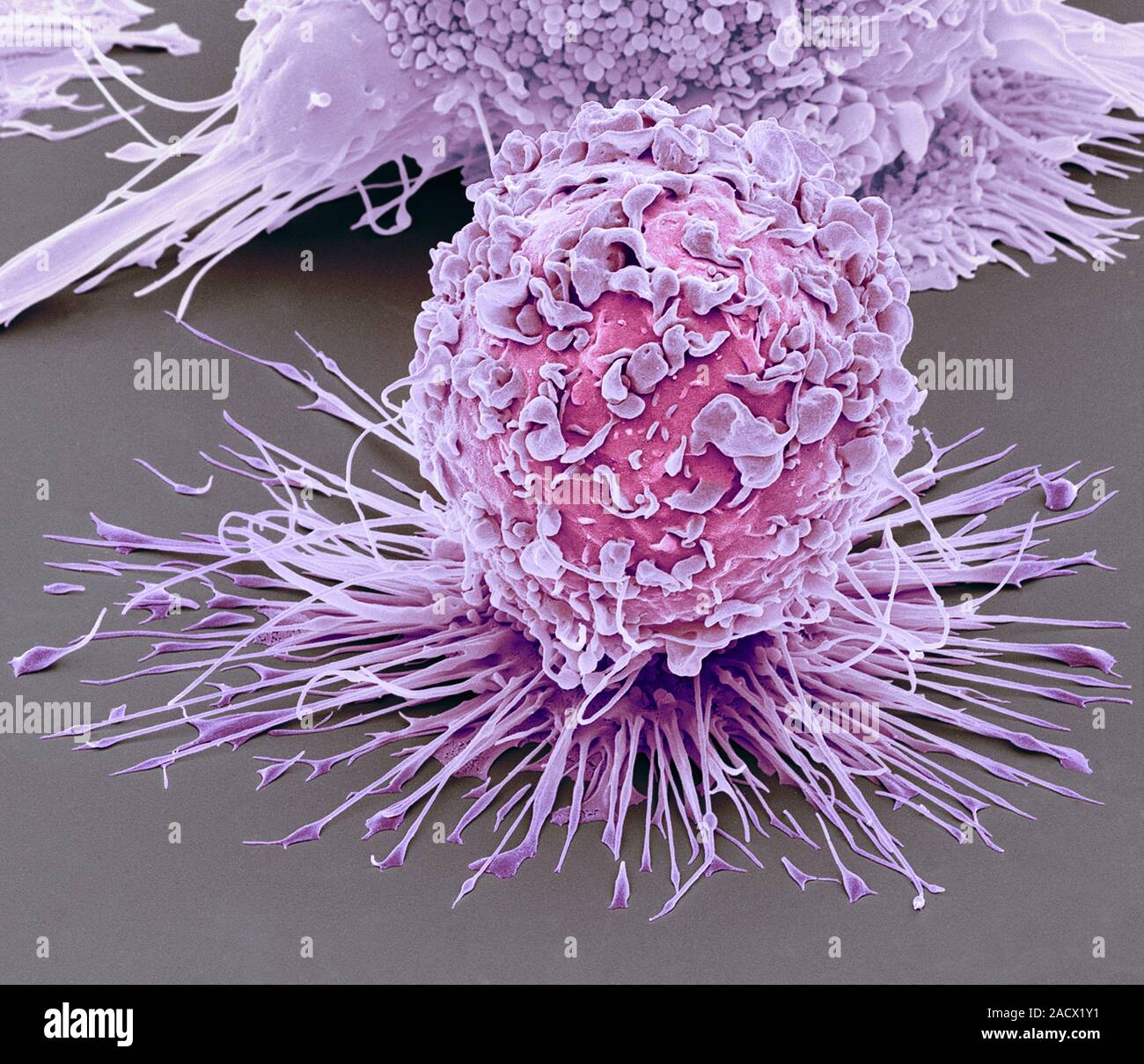 Activated macrophage. Coloured scanning electron micrograph (SEM) of an active macrophage white ...