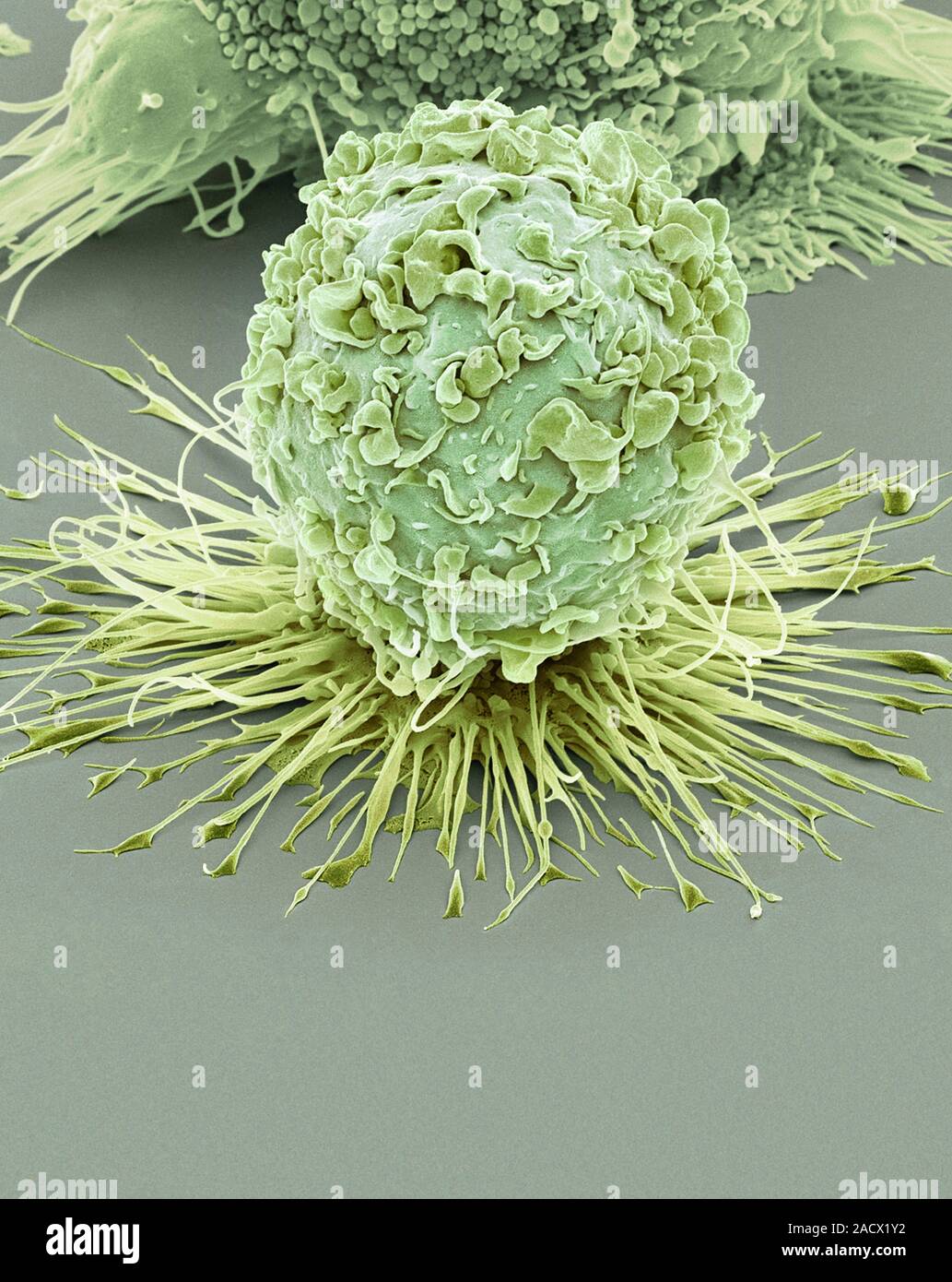 Activated macrophage. Coloured scanning electron micrograph (SEM) of an active macrophage white ...