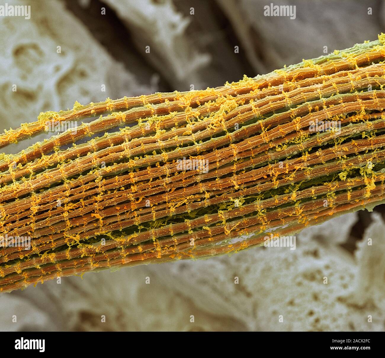 Skeletal muscle fibres. Coloured scanning electron micrograph (SEM) of a skeletal, or striated ...