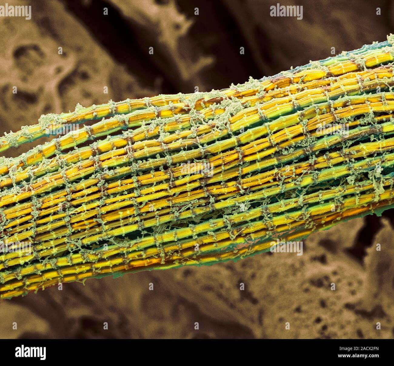 Skeletal muscle fibres. Coloured scanning electron micrograph (SEM) of a skeletal, or striated ...