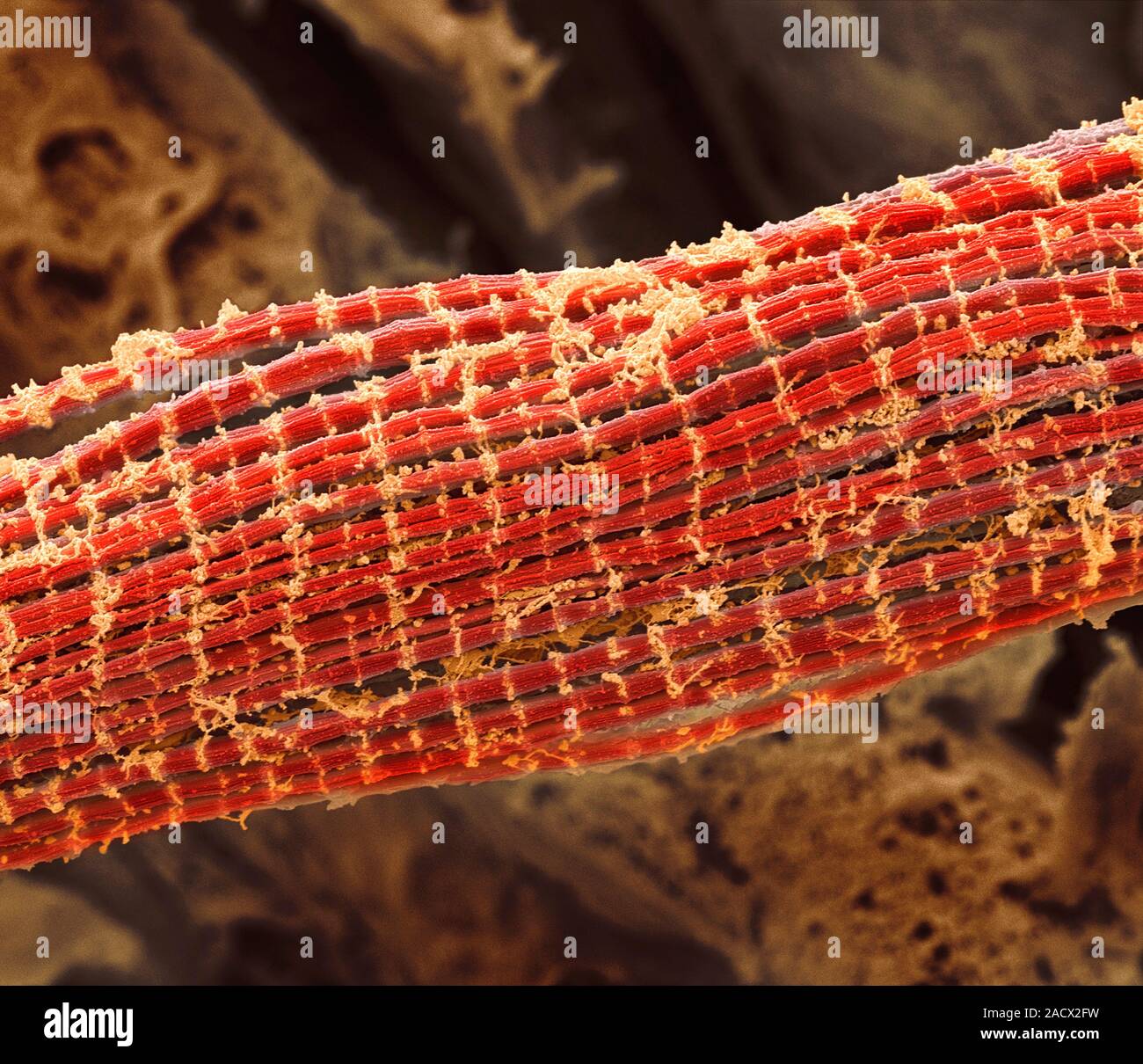 Skeletal muscle fibres. Coloured scanning electron micrograph (SEM) of a skeletal, or striated ...