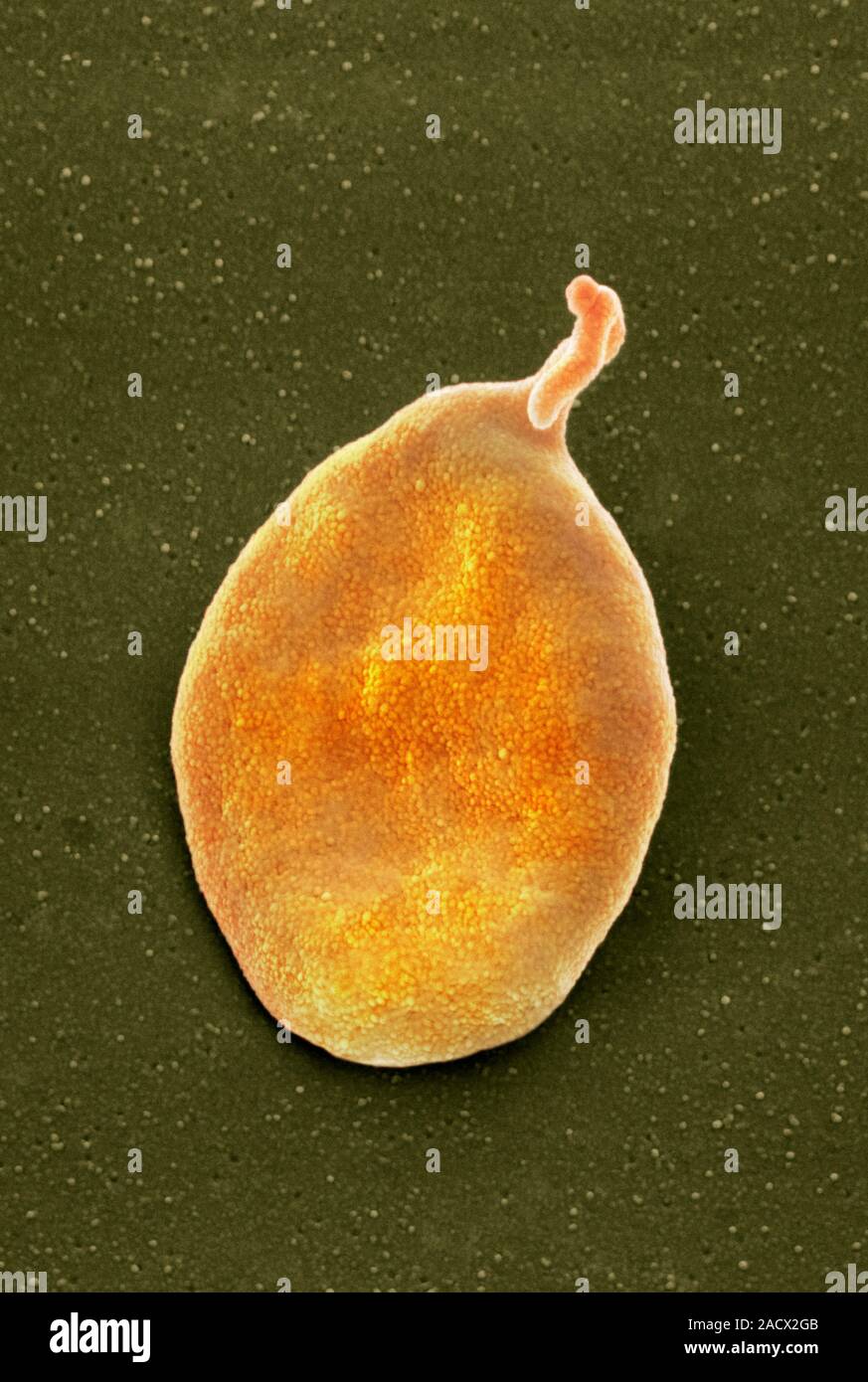 Platelet, coloured scanning electron micrograph (SEM). Platelets, or ...