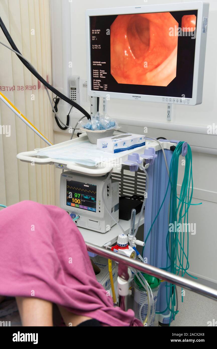 Colonoscopy being performed using an endoscope, which is a flexible ...