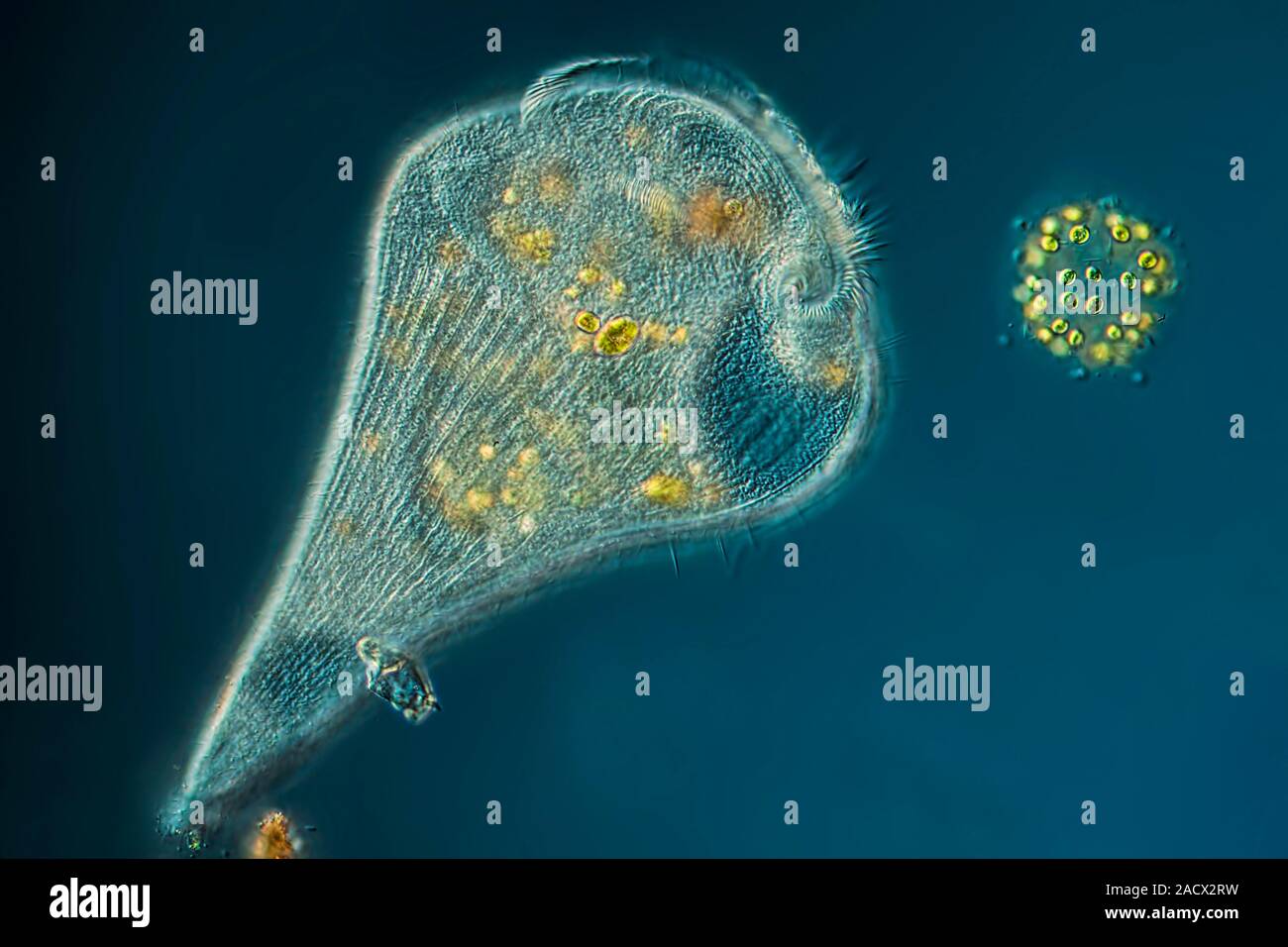 Differential interference contrast light micrograph of a Stentor sp ...