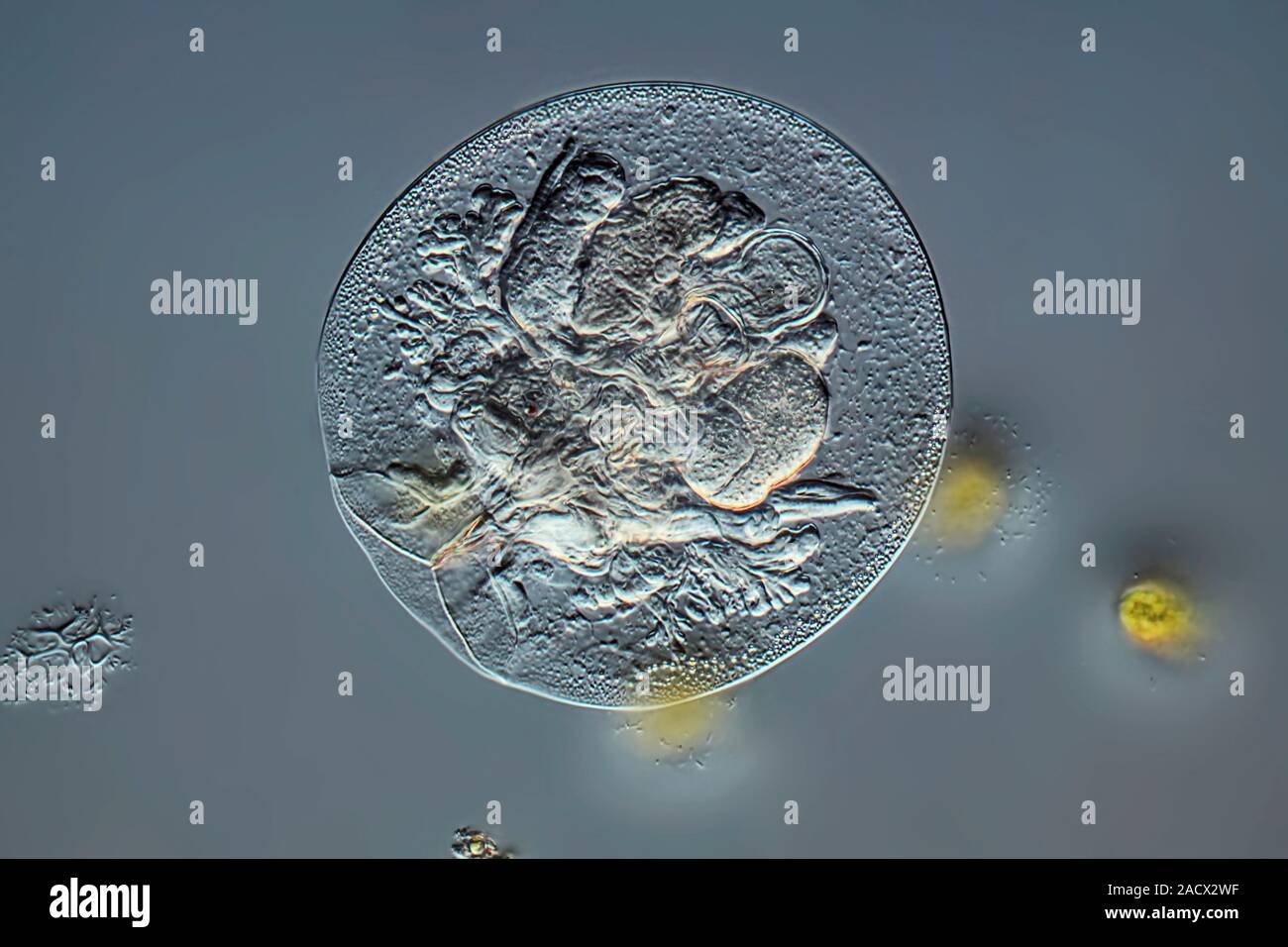 Phase contrast light micrograph of a freshwater rotifer. Rotifers are ...