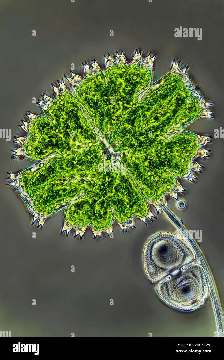 Phase contrast light micrograph of a micrasterias sp. desmid. This is a ...