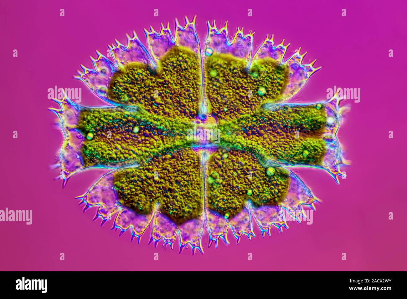 Differential interference contrast light micrograph of a micrasterias ...