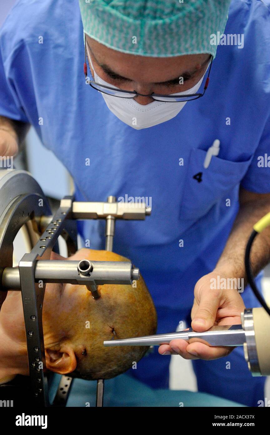 Parkinson's disease brain surgery. Surgeons implanting two electrodes ...