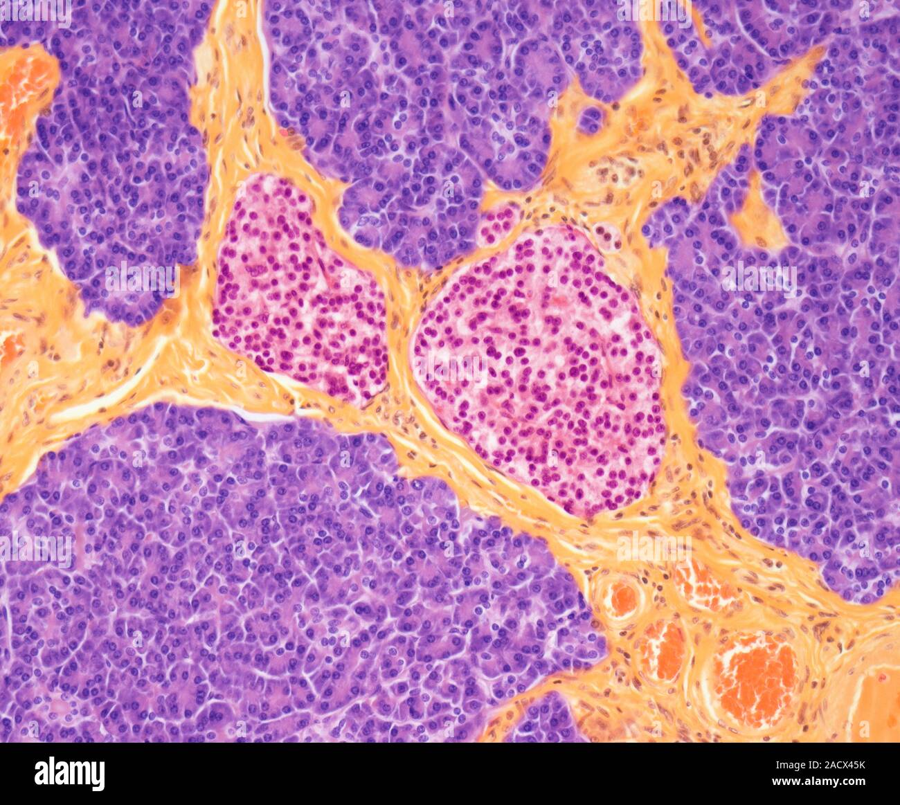 Pancreas. Light micrograph of a section through the human pancreas. The ...