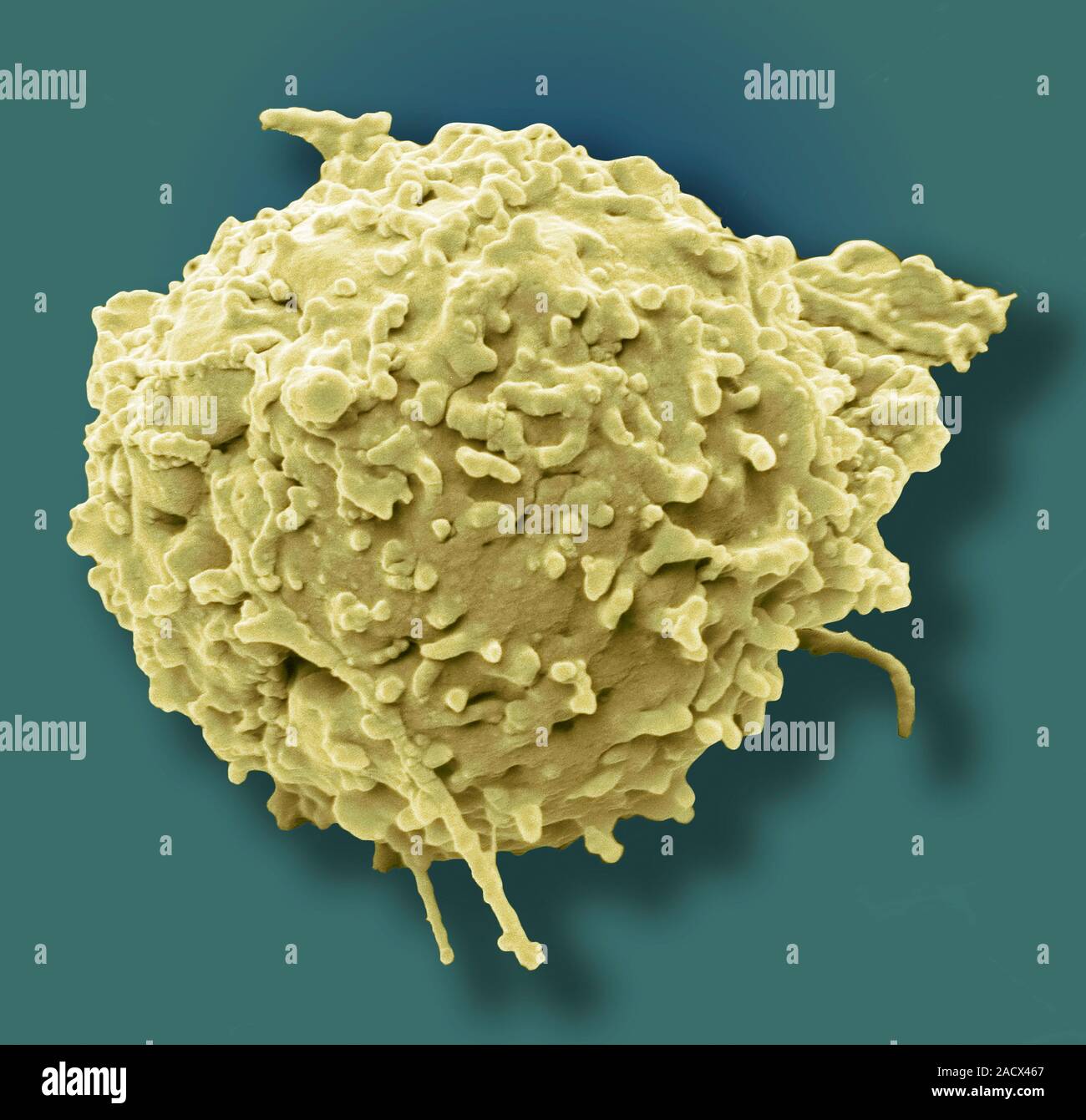 Eosinophil, coloured scanning electron micrograph (SEM). This ...