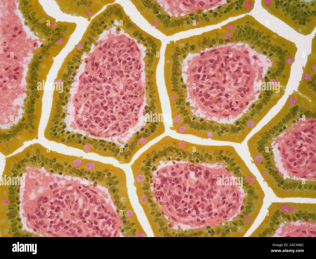 Intestinal villi. Light micrograph of a section through the villi of ...