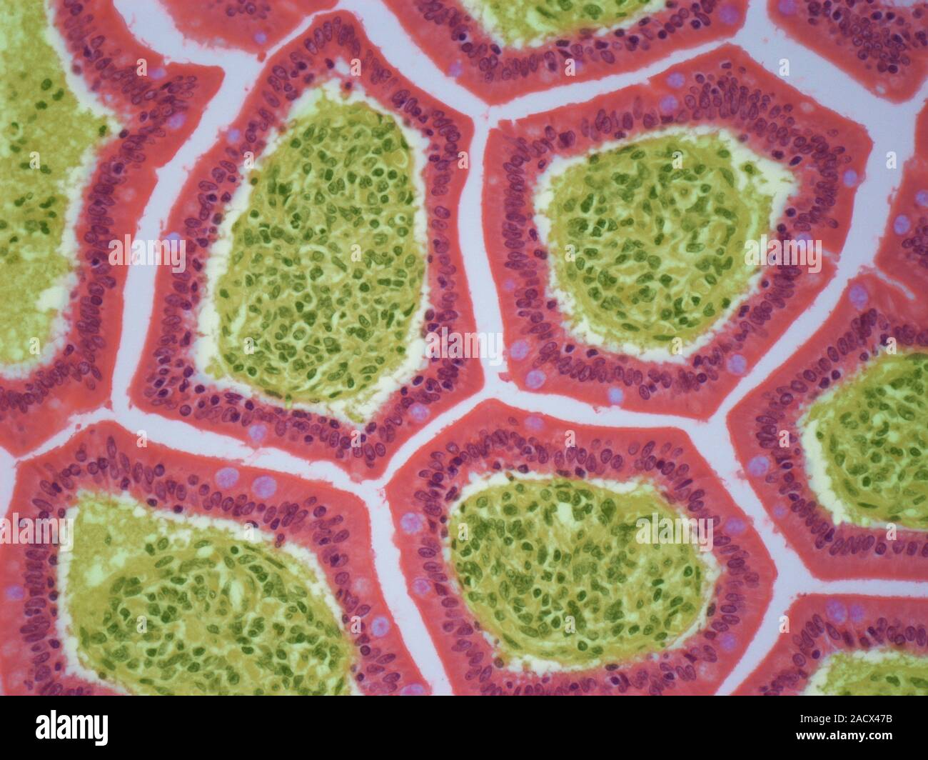 Intestinal villi. Light micrograph of a section through the villi of ...
