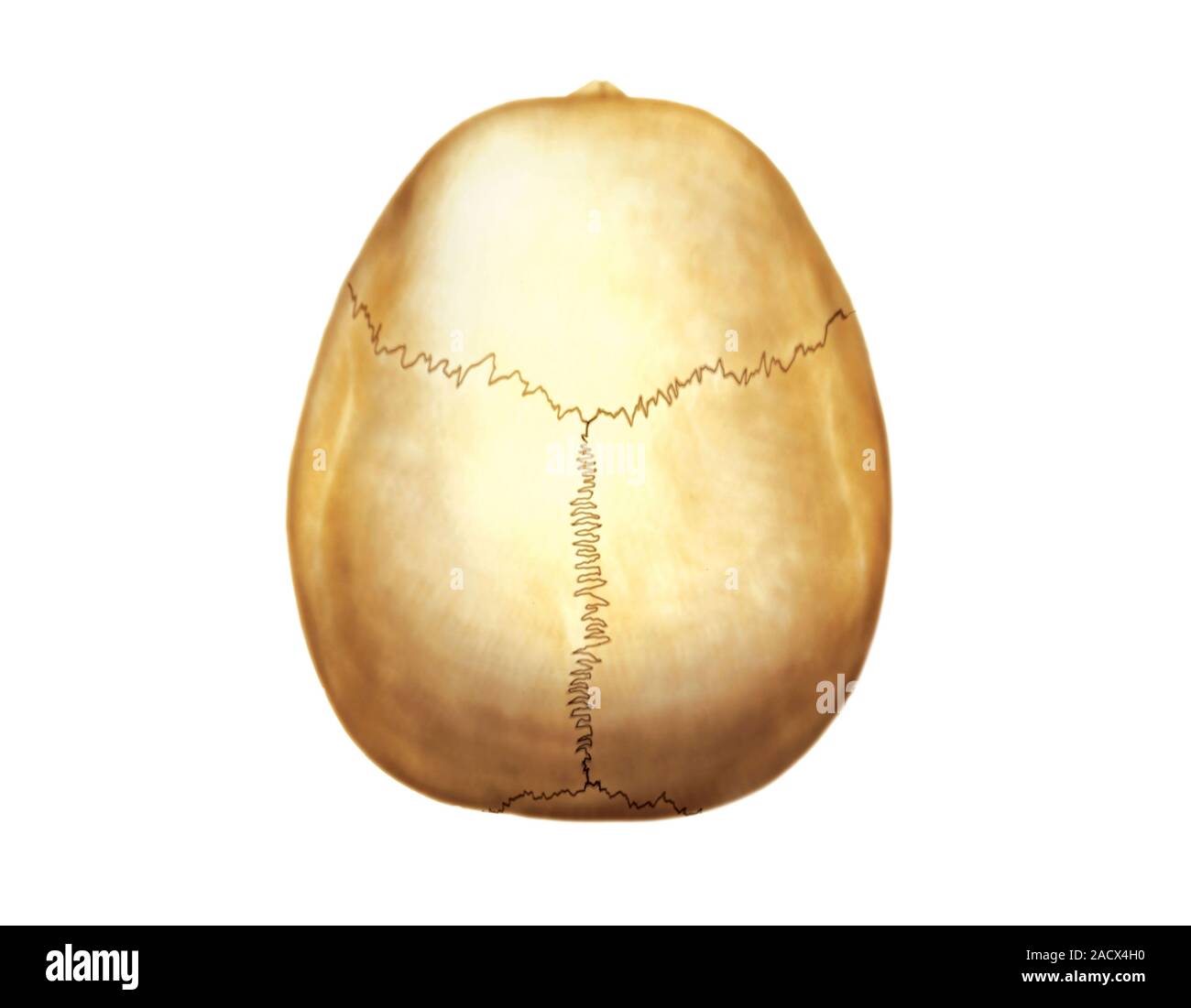 Illustration of the cranium. This is a superior view. Illustration from 'Asklepios Atlas of the ...