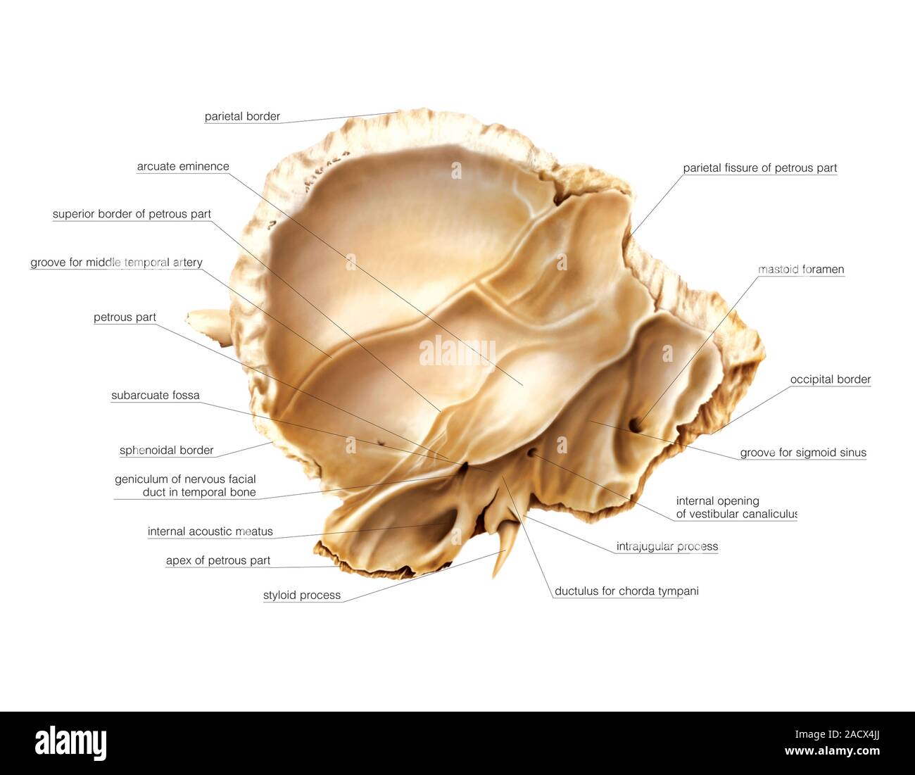 Illustration of the Temporal bone of the cranium. This is a medial view (labelled). Illustration ...