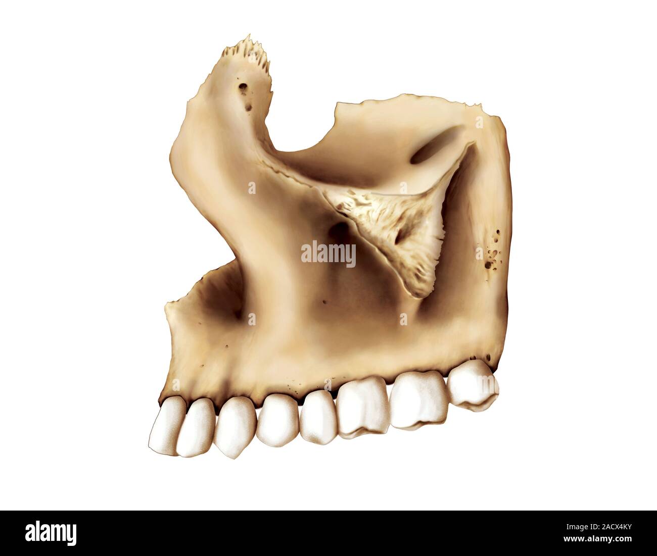 Illustration of the Maxilla bone of the cranium. This is a lateral view ...