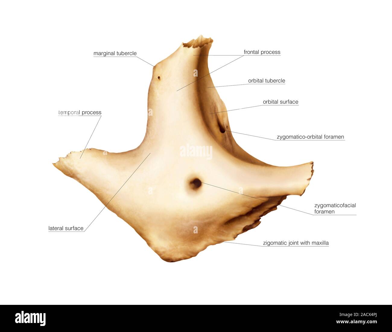 Illustration of the Zygomatic bone of the cranium. This is a lateral ...