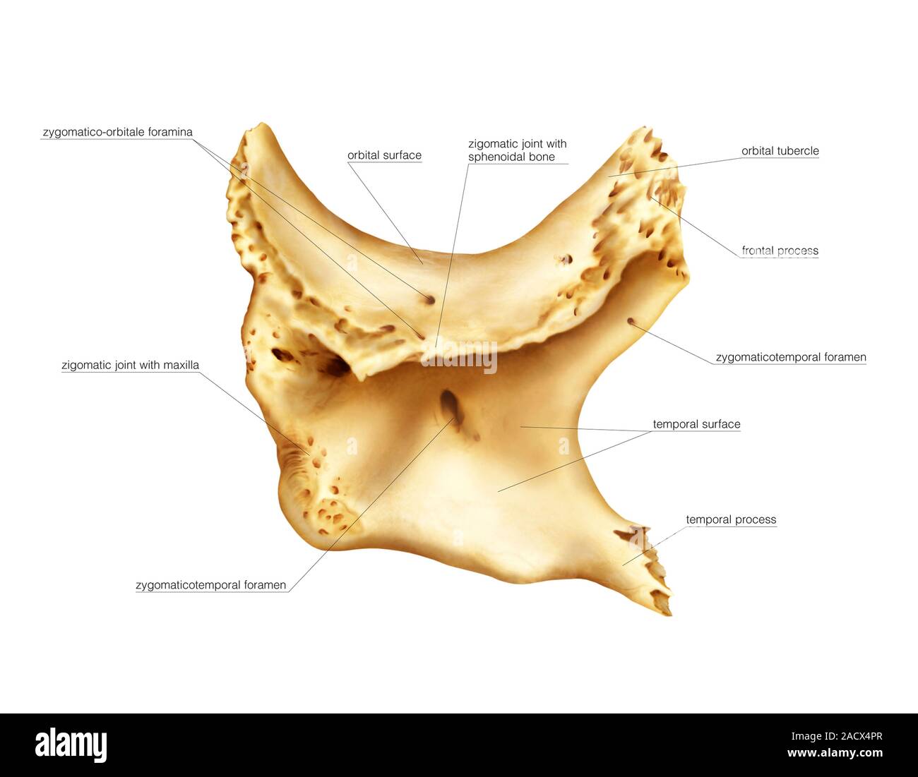 Illustration of the Zygomatic bone of the cranium. This is a medial view (labelled ...