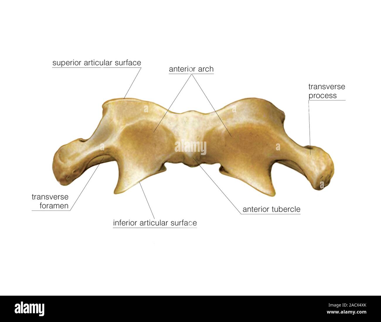 Illustration of the Atlas vertebra. This is an anterior view (labelled ...