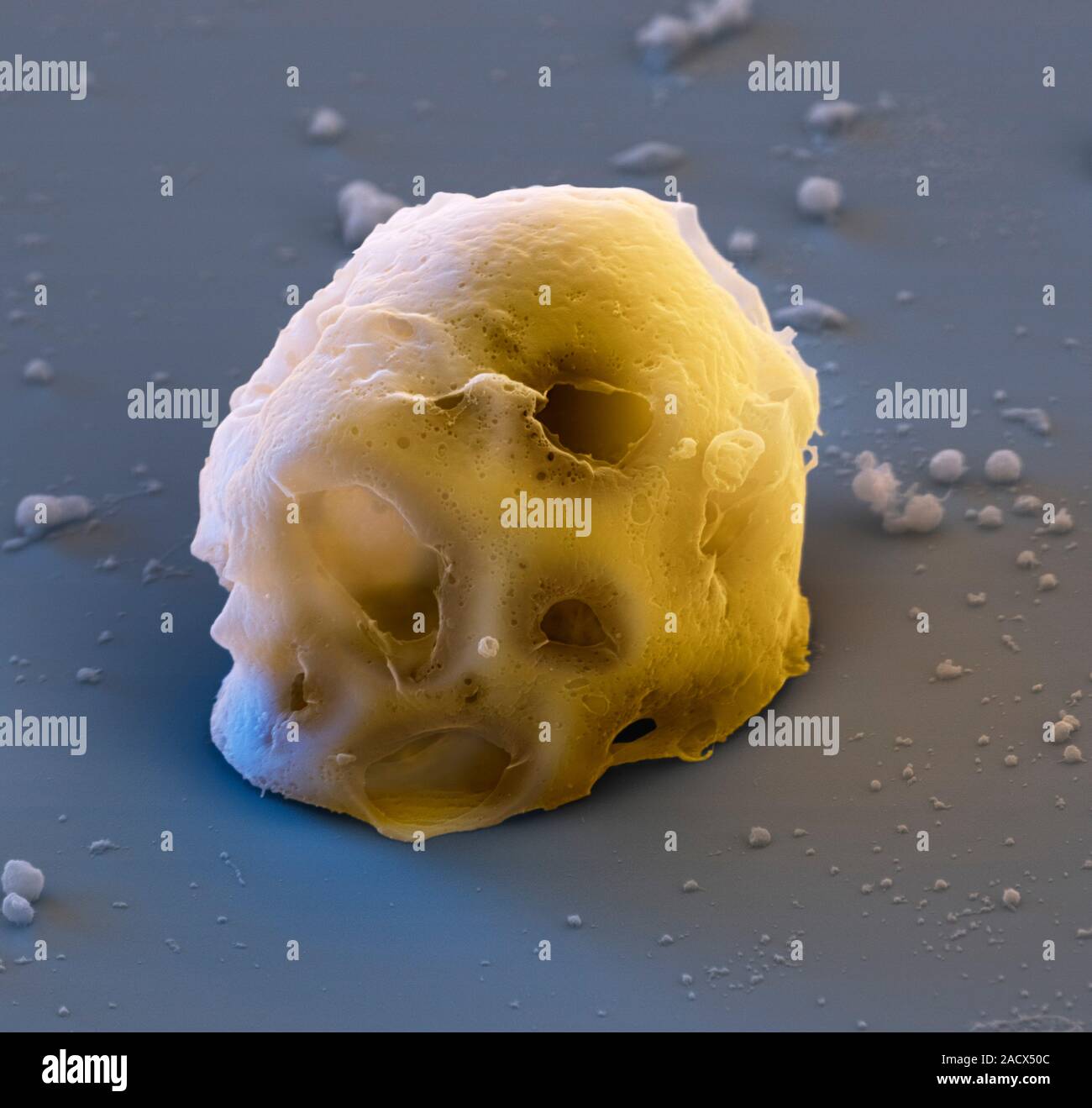 Apoptosis. Coloured scanning electron micrograph (SEM) of an ...