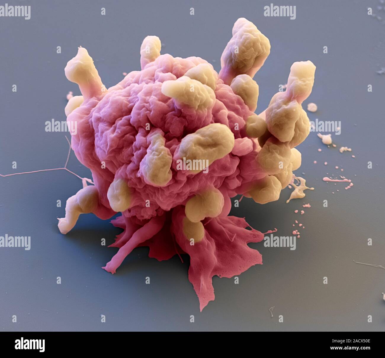 Apoptosis Coloured Scanning Electron Micrograph Sem Of An
