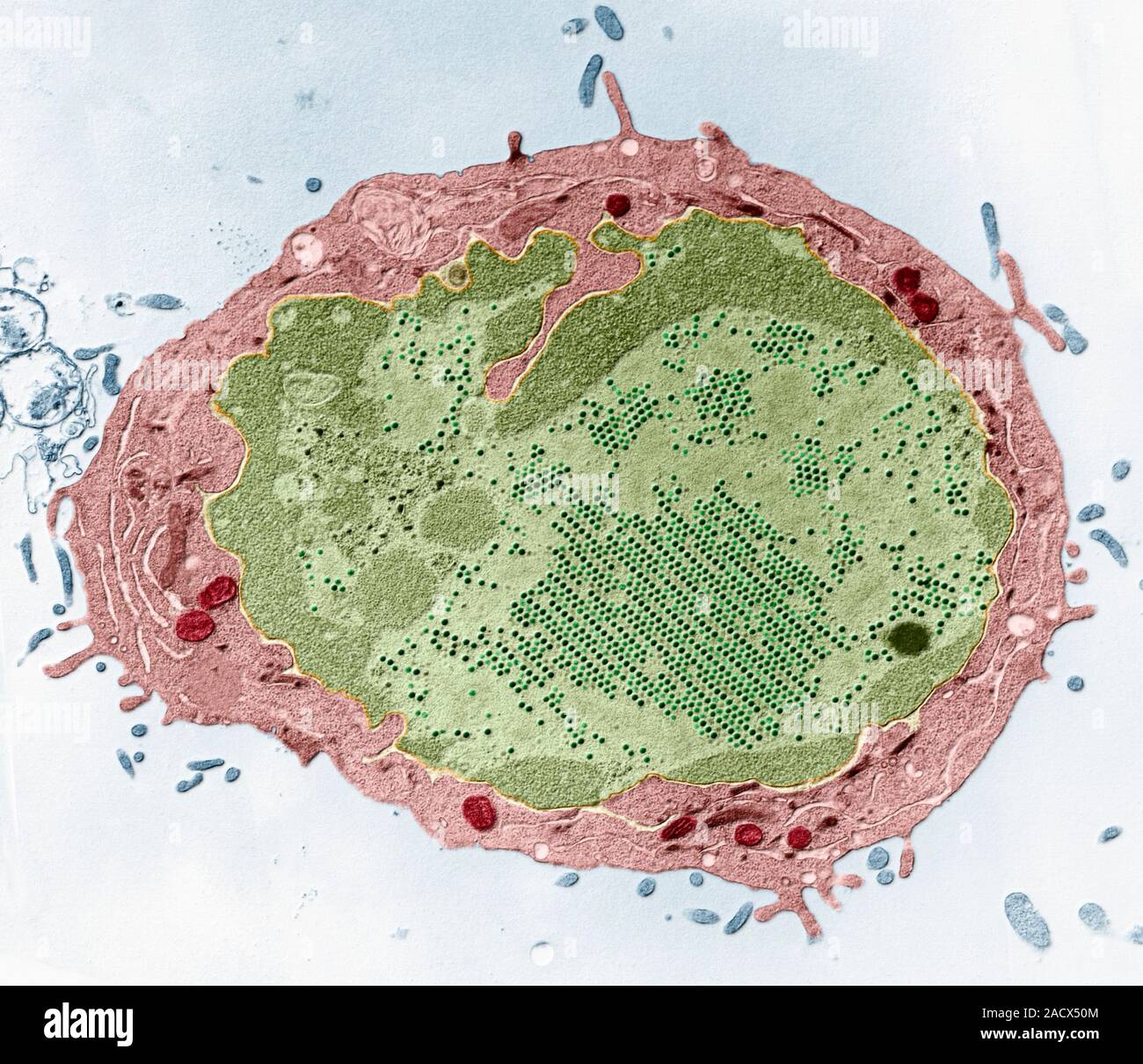 Adenoviruses. Coloured transmission electron micrograph (TEM) of a cell ...