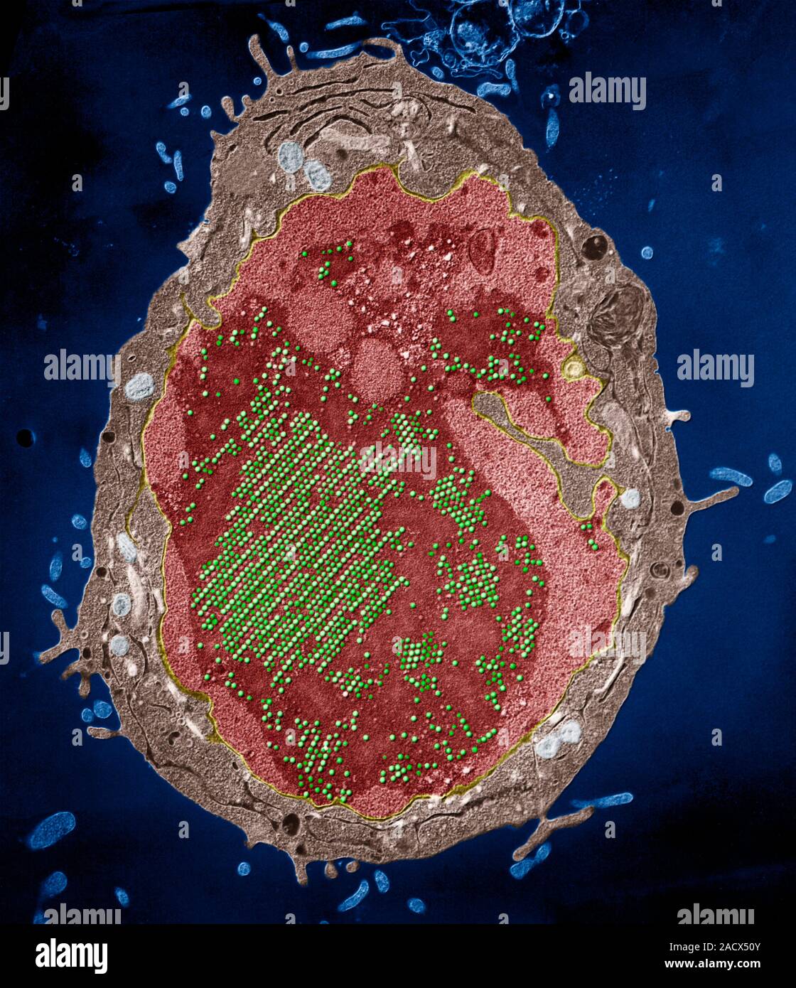 Adenoviruses Coloured Transmission Electron Micrograph Tem Of A Cell Infected With Adenovirus