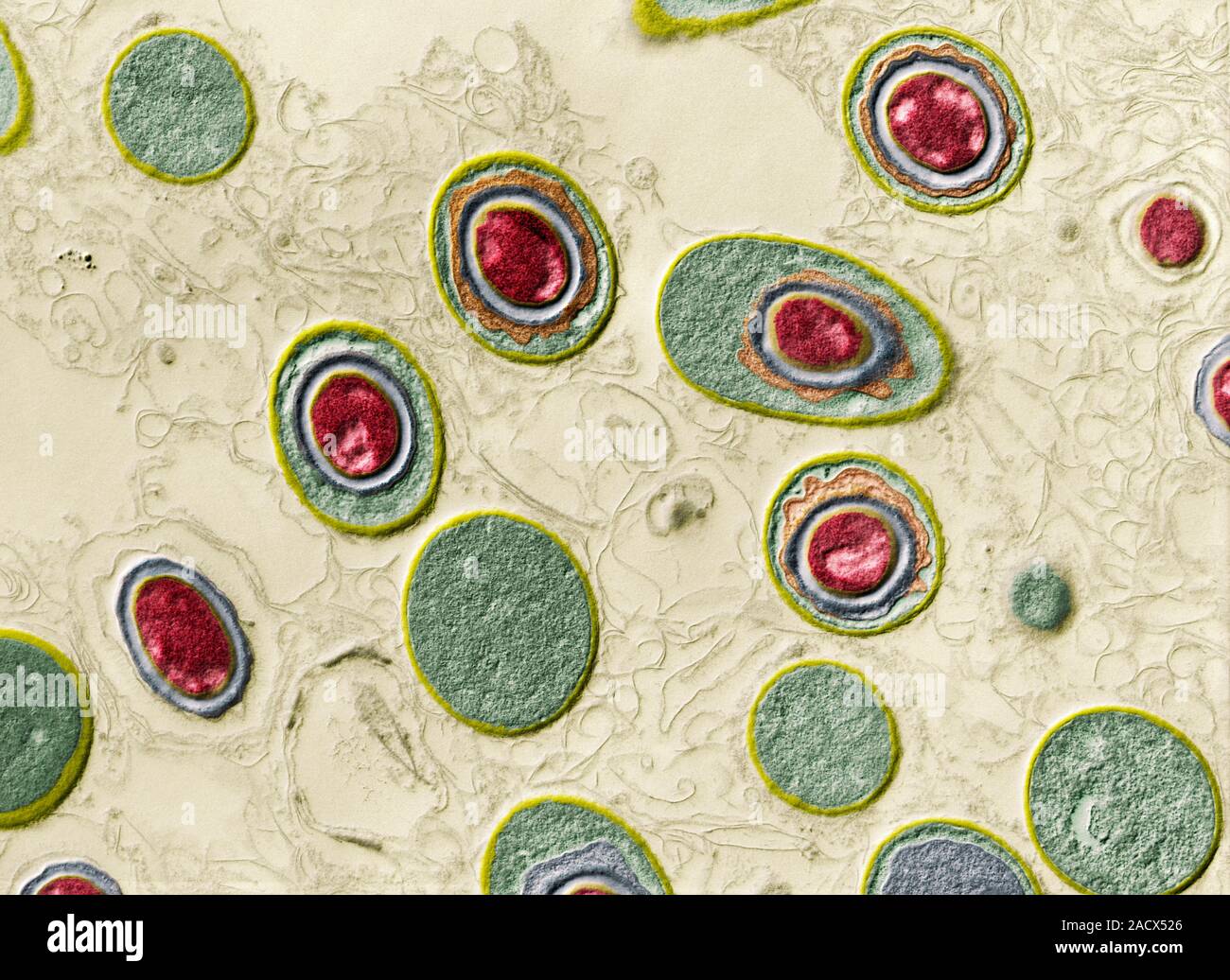 Anthrax bacteria. Coloured transmission electron micrograph (TEM) of ...