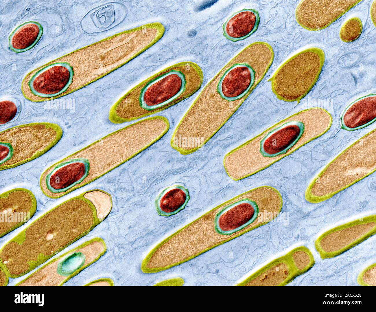 Anthrax bacteria. Coloured transmission electron micrograph (TEM) of ...